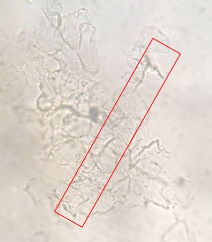 Microscopia de Fungos Filamentosos (BOLORES) e Fungos Leveduriformes ...